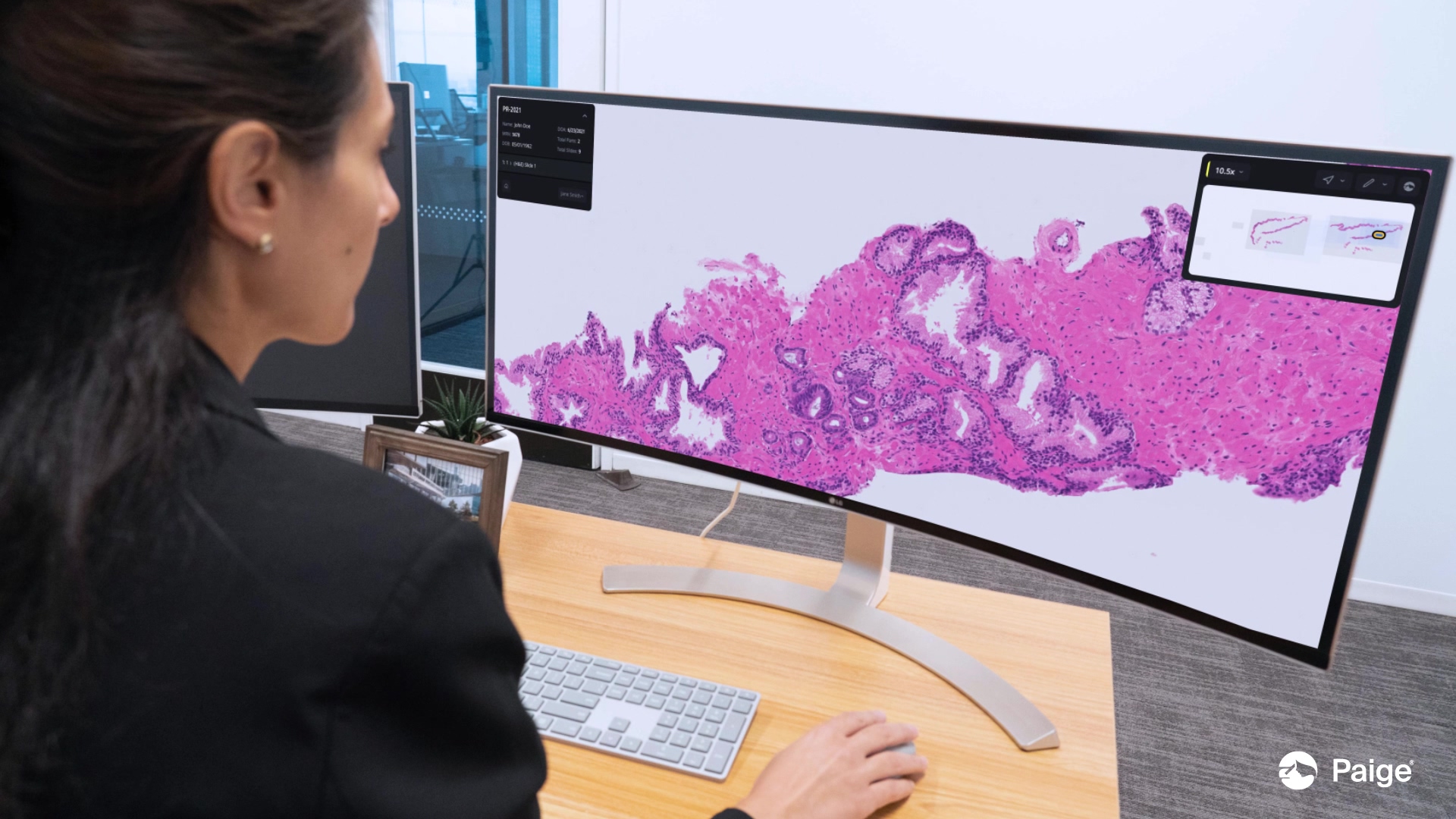 Introducing FDA-Approved Paige Prostate